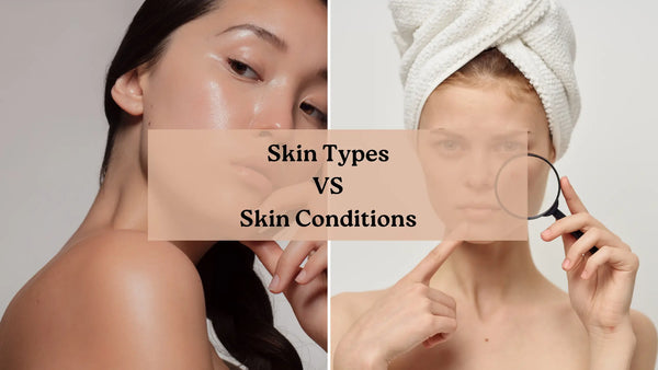 Skin Types VS Skin Conditions – YUNIBA