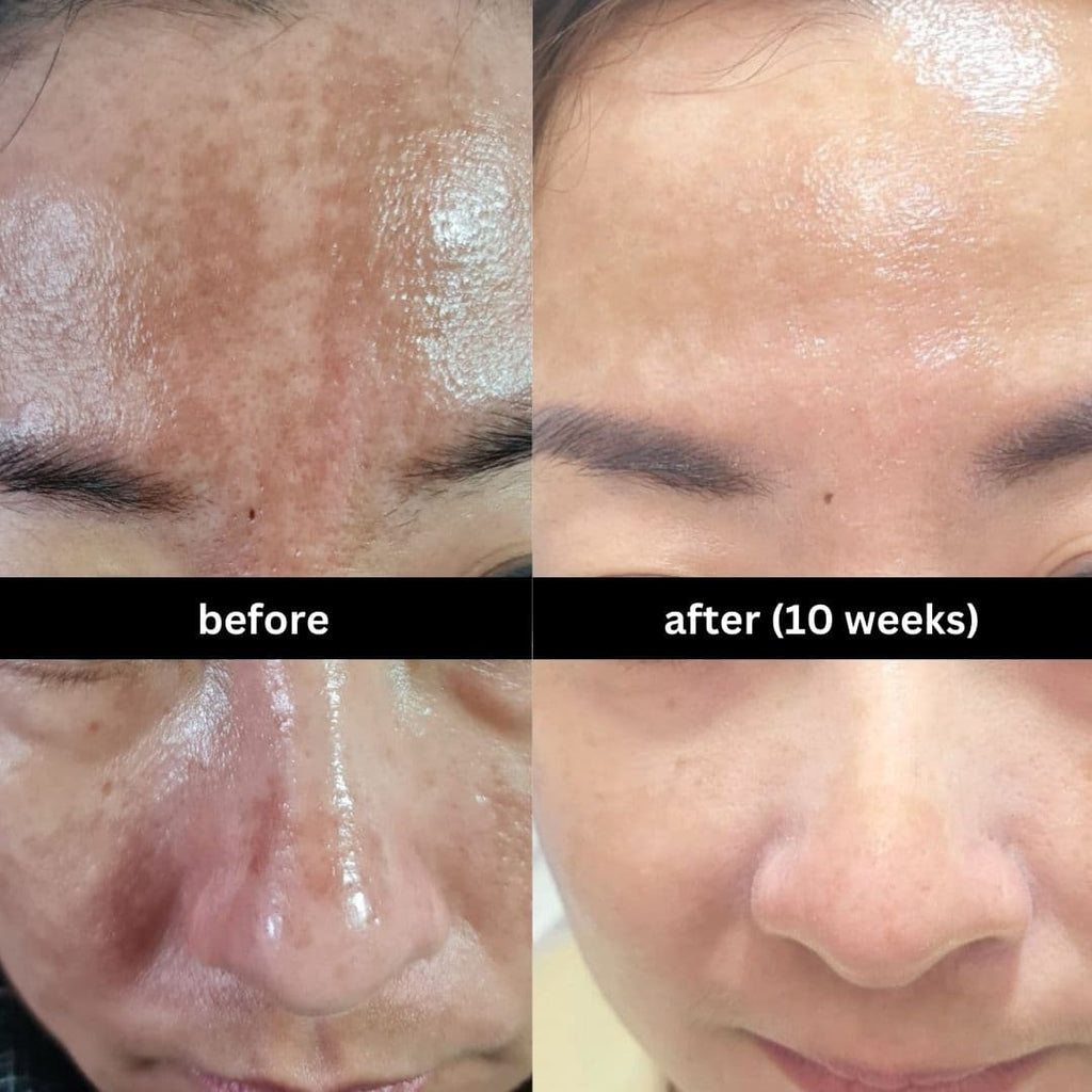 Beta White (Brightening Serum) – Skincare That Fits All