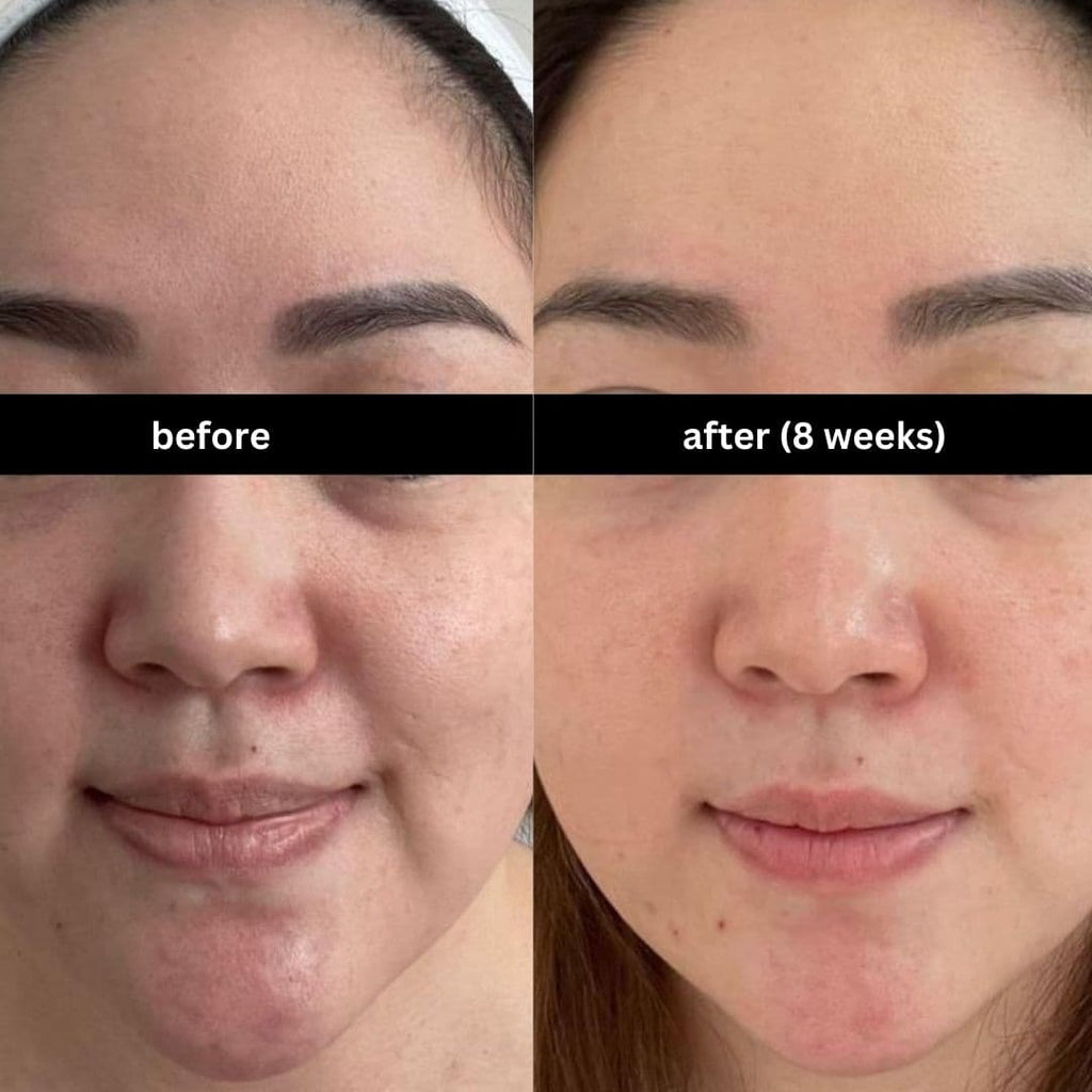 Multi Repair Serum – YUNIBA
